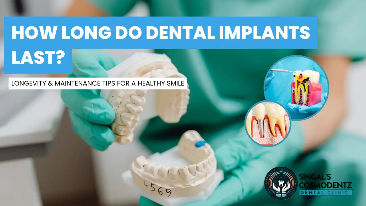 Dental Implant Lifespan: Longevity & Care Tips